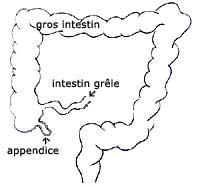 L'appendicite